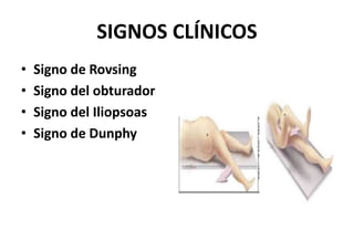 Apendicitis en el embarazo | PPTX