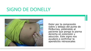 Apendicitis.pptx