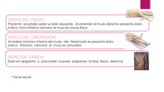 Apendicitis | PPT
