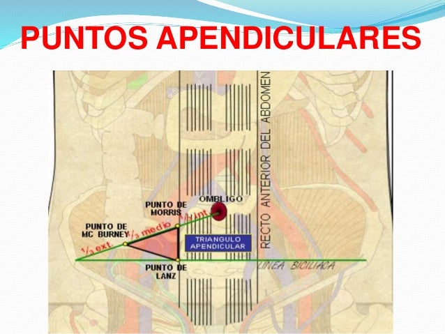 Apendicitis Cirugía Abdomen