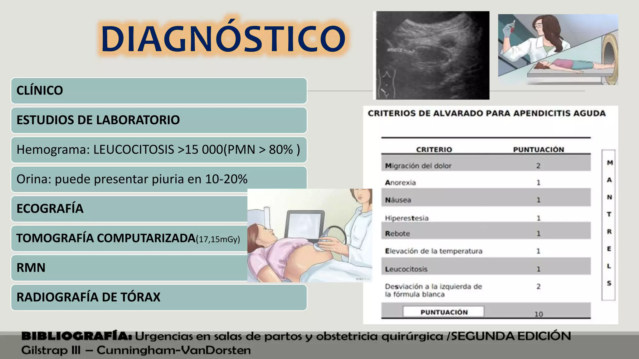 APENDICITIS EN EL EMBARAZO OBSTETRICIA | PPT