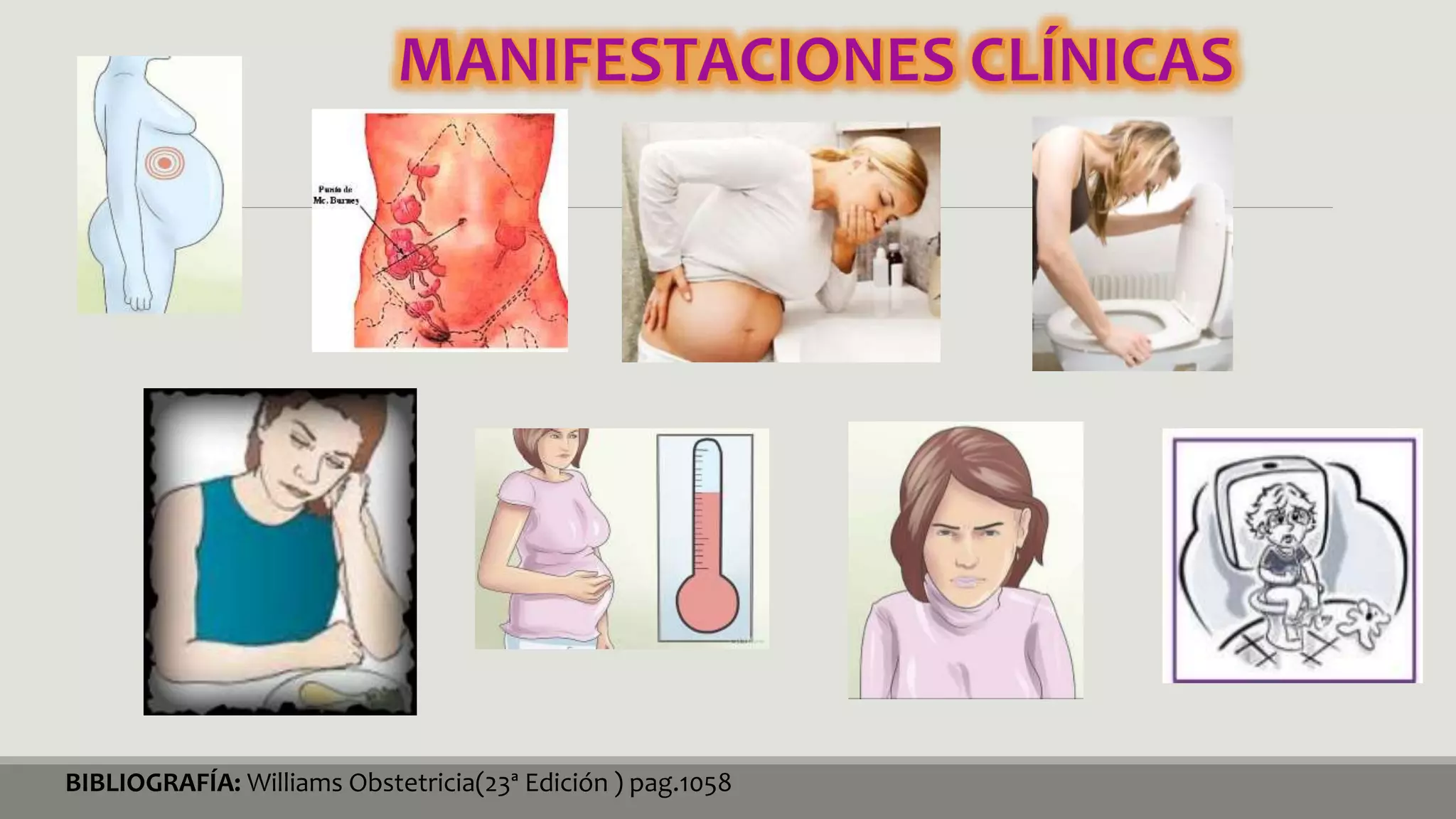 APENDICITIS EN EL EMBARAZO OBSTETRICIA | PPT
