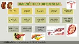 APENDICITIS EN EL EMBARAZO OBSTETRICIA | PPTX