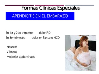Apendicitis | PPTX