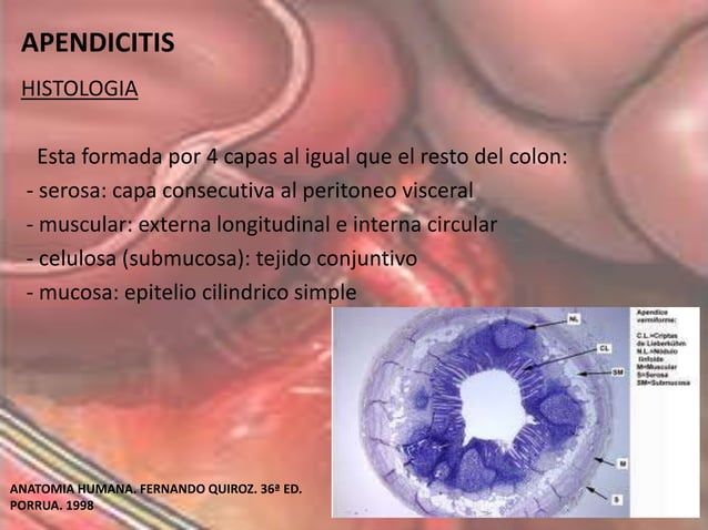 Apendicitis 3 Pptx Descarga Gratuita