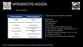 APENDICITIS AG.pptx