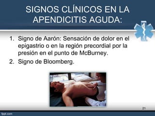 Apendicitis aguda | PPT