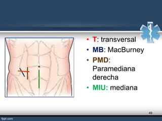 Apendicitis aguda | PPT