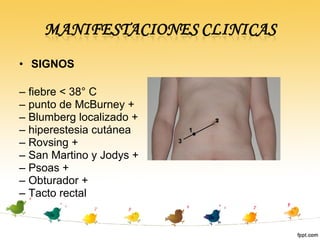 Prueba De Puntos De Mcburney