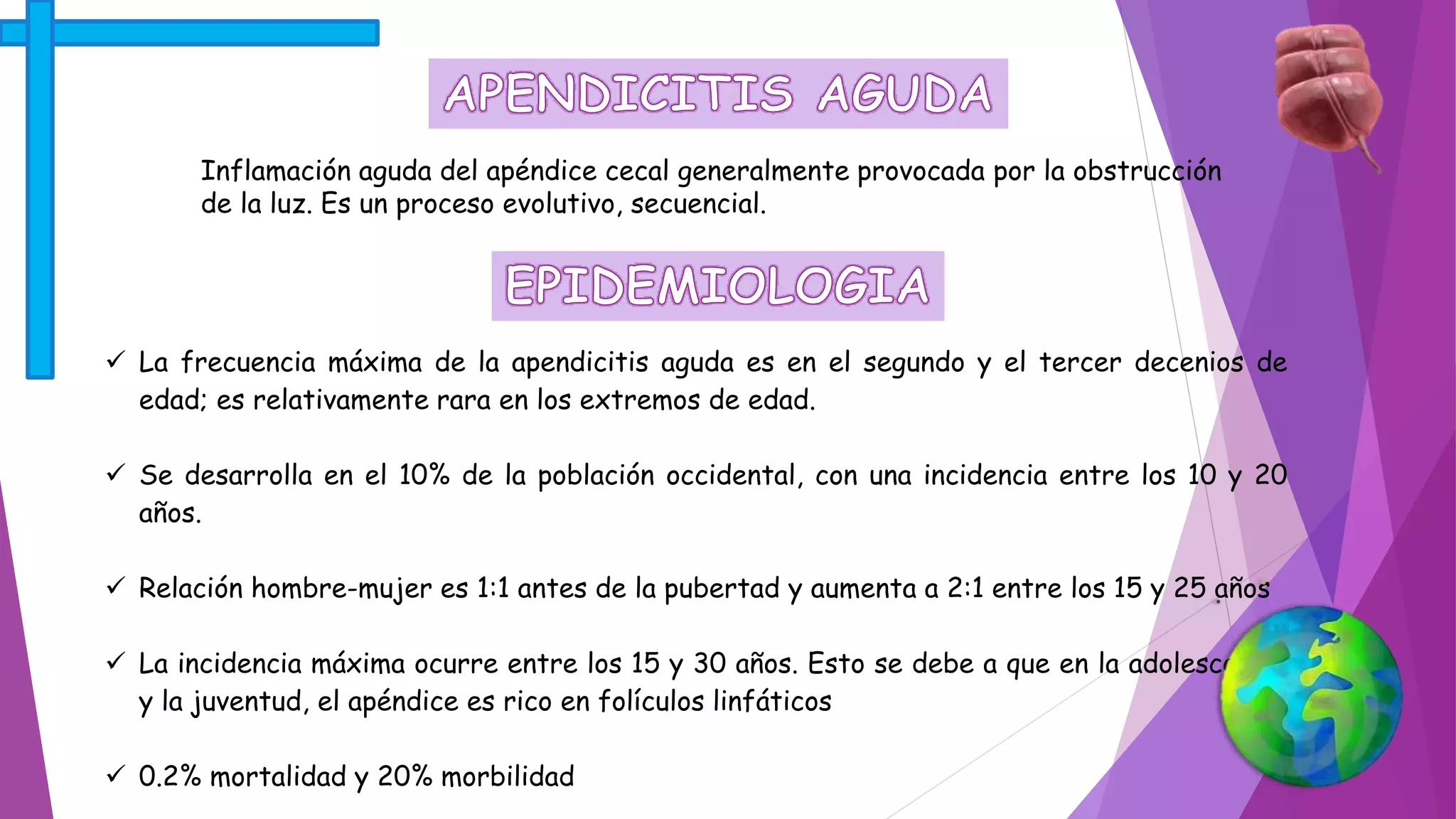 Apendicitis aguda | PPTX