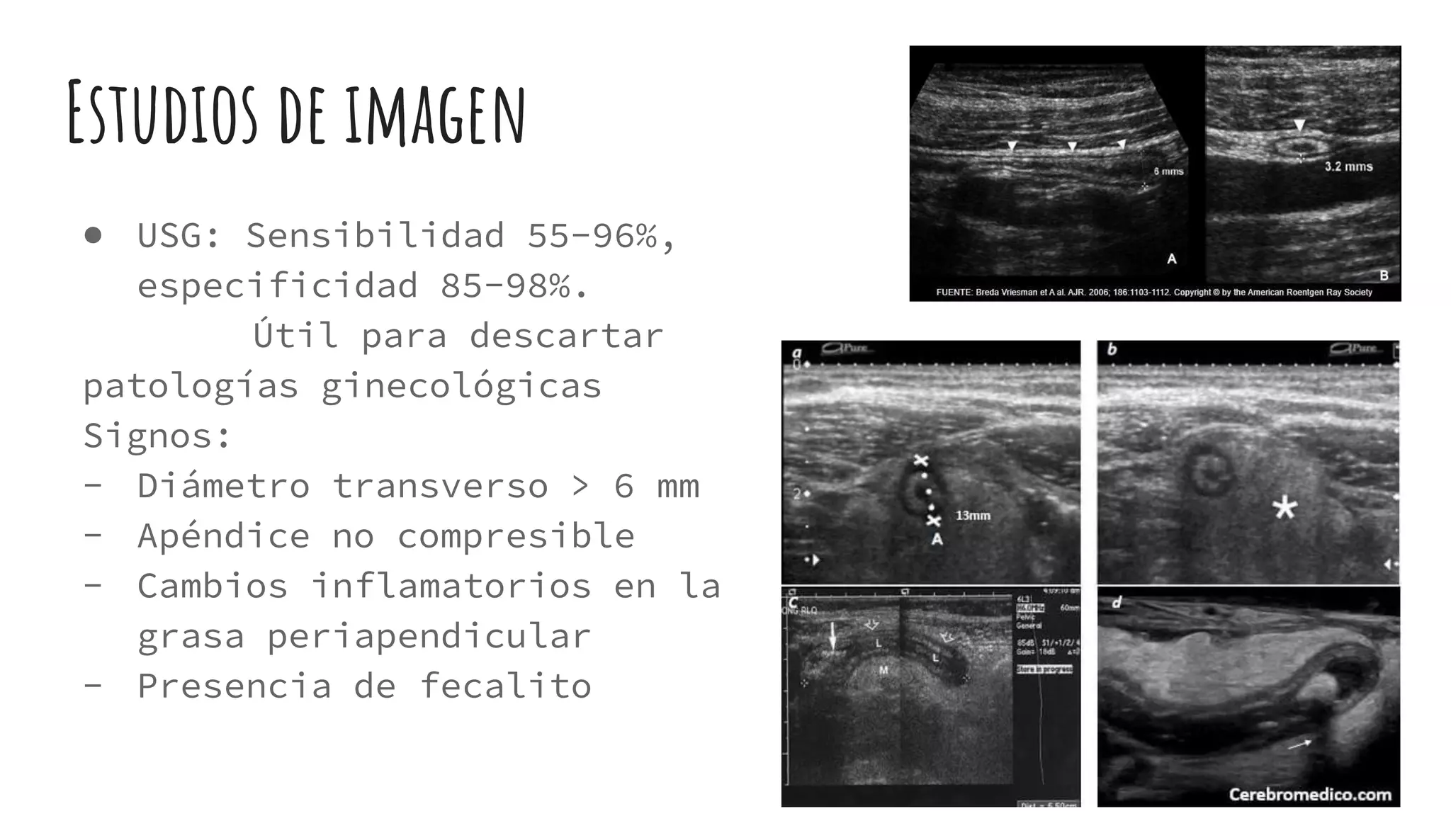 Apendicitis aguda, Caso clínico y Revisión de tema. | PDF