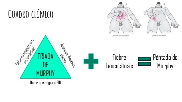 Apendicitis aguda, Caso clínico y Revisión de tema.