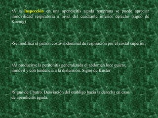 Apendicitis Aguda | PPT