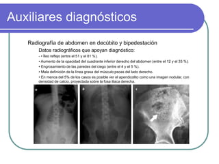 Apendicitis aguda..ppt