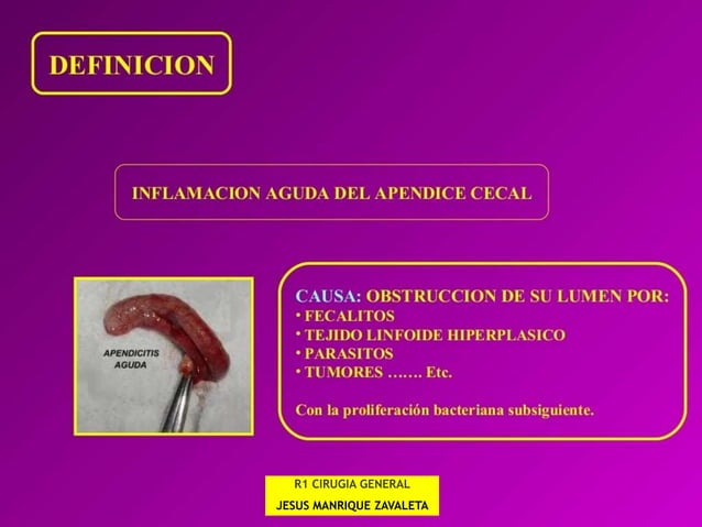 APENDICITIS AGUDA ANATOMIA Y CIRUGIA LAPATOSCOPICA | PPTX