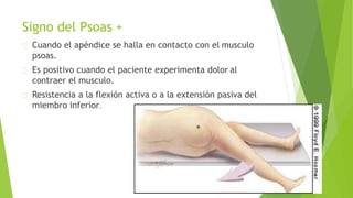 Apendicitis Aguda. presentación resumida | PPTX