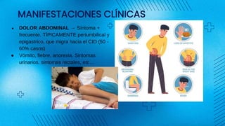 APENDICITIS AGUDA.pttx universidad cooperativa | PPTX