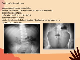 APENDICITIS AGUDA. Guía basada en evidencia sobre el tratamiento y ...