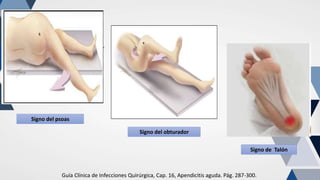Apendicitis Aguda.pptx manejo quirúrgico | PPTX
