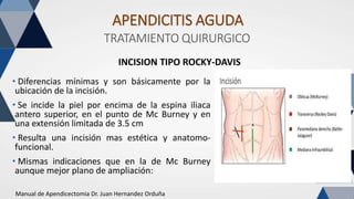 Apendicitis Aguda.pptx manejo quirúrgico | PPTX