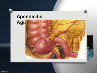 apendicitis aguda y sus fases en la enfermedad del paciente | PPT
