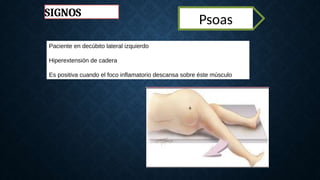 EXPOSICION SOBRE CUADRO DE APENDICITIS AGUDA | PPTX
