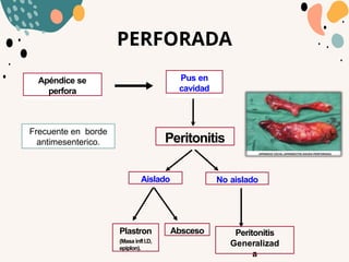 Abordaje de Apendicitis Aguda y diagnóstico.pptx