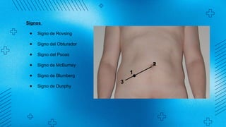 Apendicitis aguda y guías de Tokyo25pptx | PPTX
