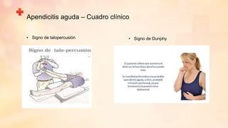 Apendicitis aguda explicada al 1000.pptx