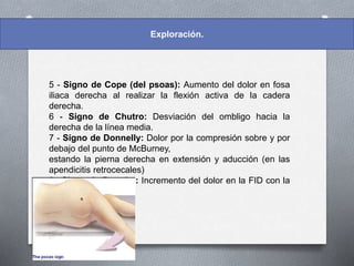 apendicitis aguda 8b.pptx