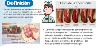 APENDICITIS AGUDA PROCESO DE ATENCIÓN DE ENFERMERÍA | PDF