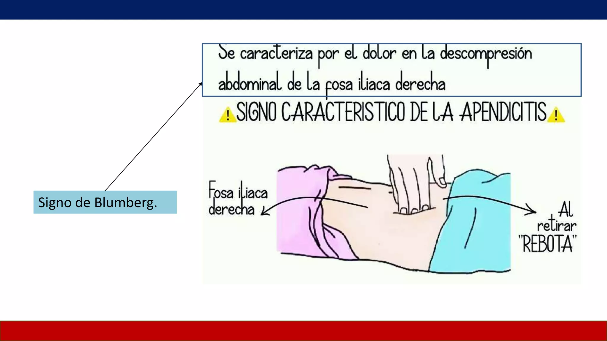 APENDICITIS AGUDA CIRUGÍA PROYECTAR.pptx