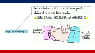 APENDICITIS AGUDA CIRUGÍA PROYECTAR.pptx