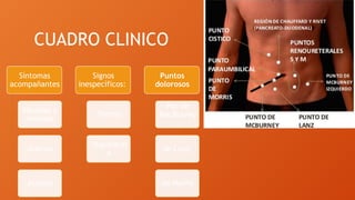Apendicitis aguda CIRUGIA tipos y clasificacion.pptx