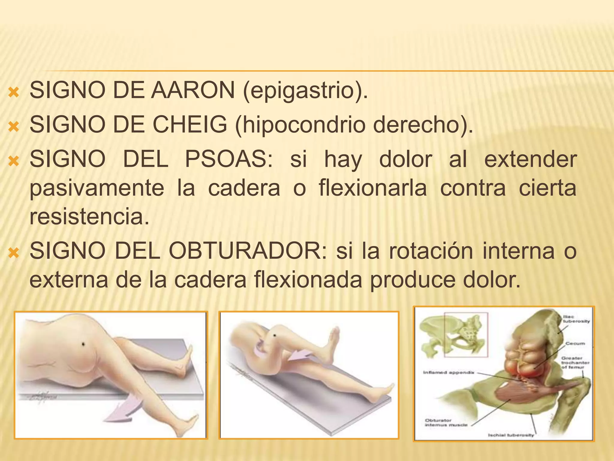 Apendicitis aguda cjmt | PPTX