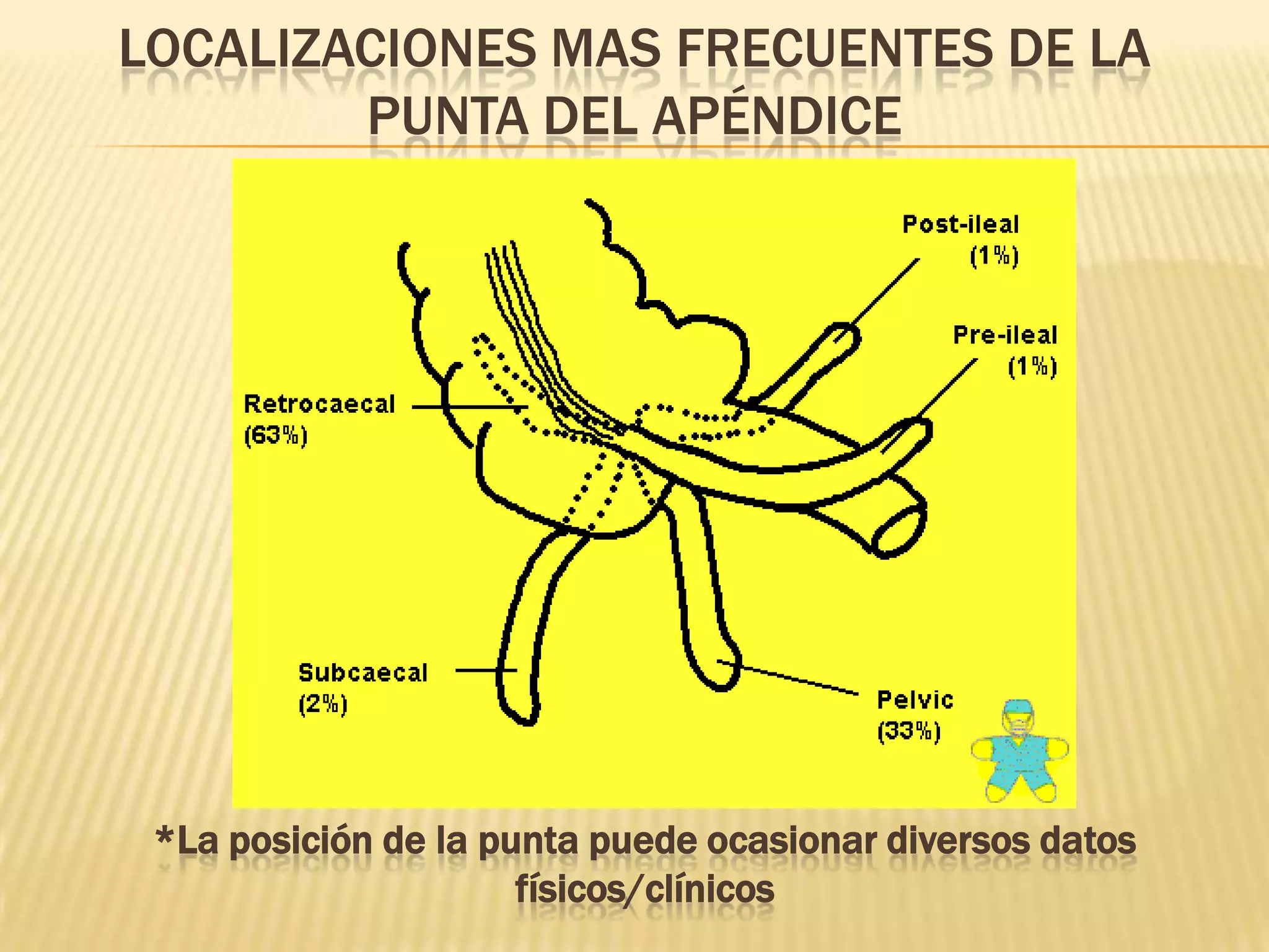 Apendicitis aguda cjmt | PPTX