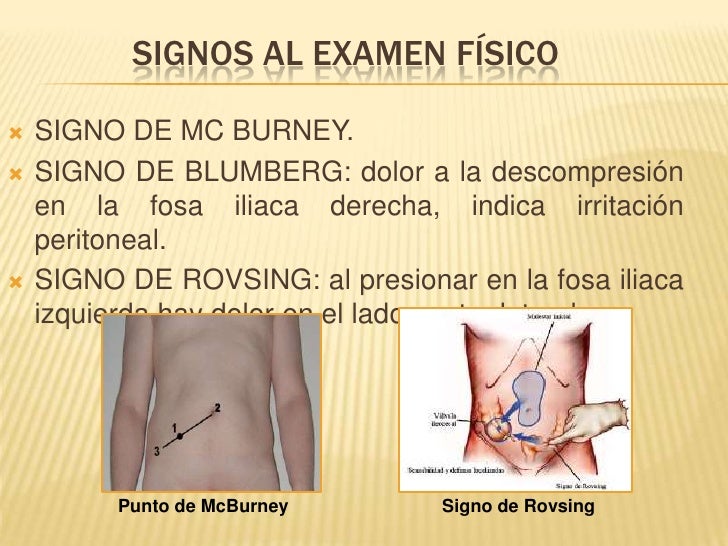 Apendicitis aguda cjmt