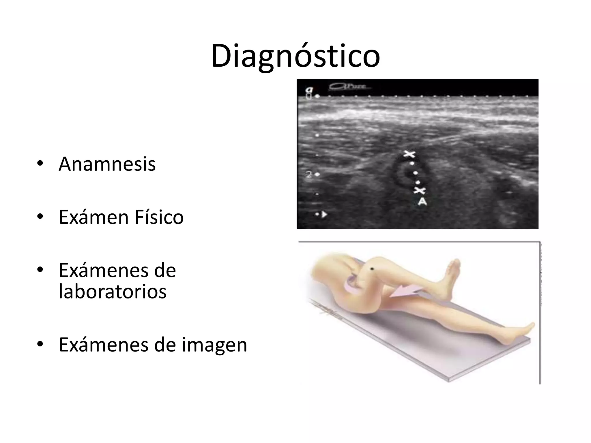 Apendicitis aguda en el embarazo | PPTX | Pregnancy | Reproductive Health