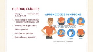 APENDICITIS AGUDA EN PEDIATRÍA.pptx