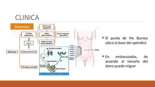 APENDICITIS AGUDA CONCEPTO, MANEJO, TRATAMIENTO | PPTX
