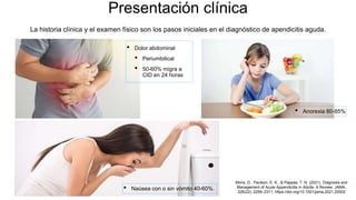 Apendicitis Aguda segun nuevas guias de practica clinica | PPTX