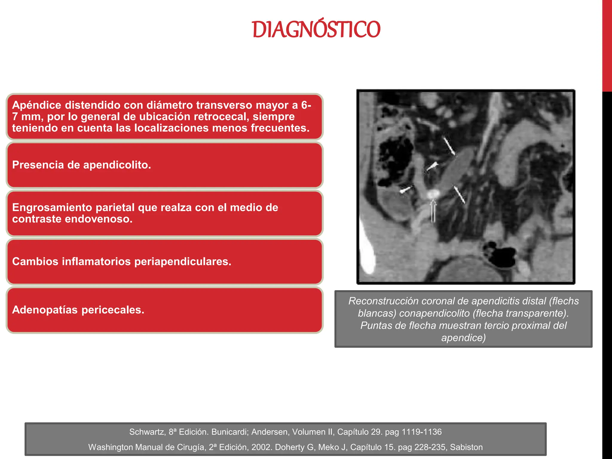 apendicitis aguda introduccion y manejopptx | PPTX