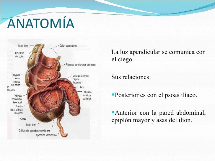 "Apendicitis" por Carlos Altamirano