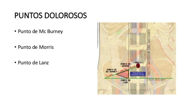 Apendicitis cirugía