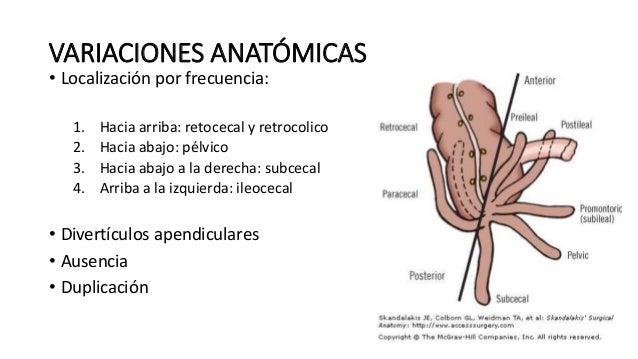 Apendicitis cirugía