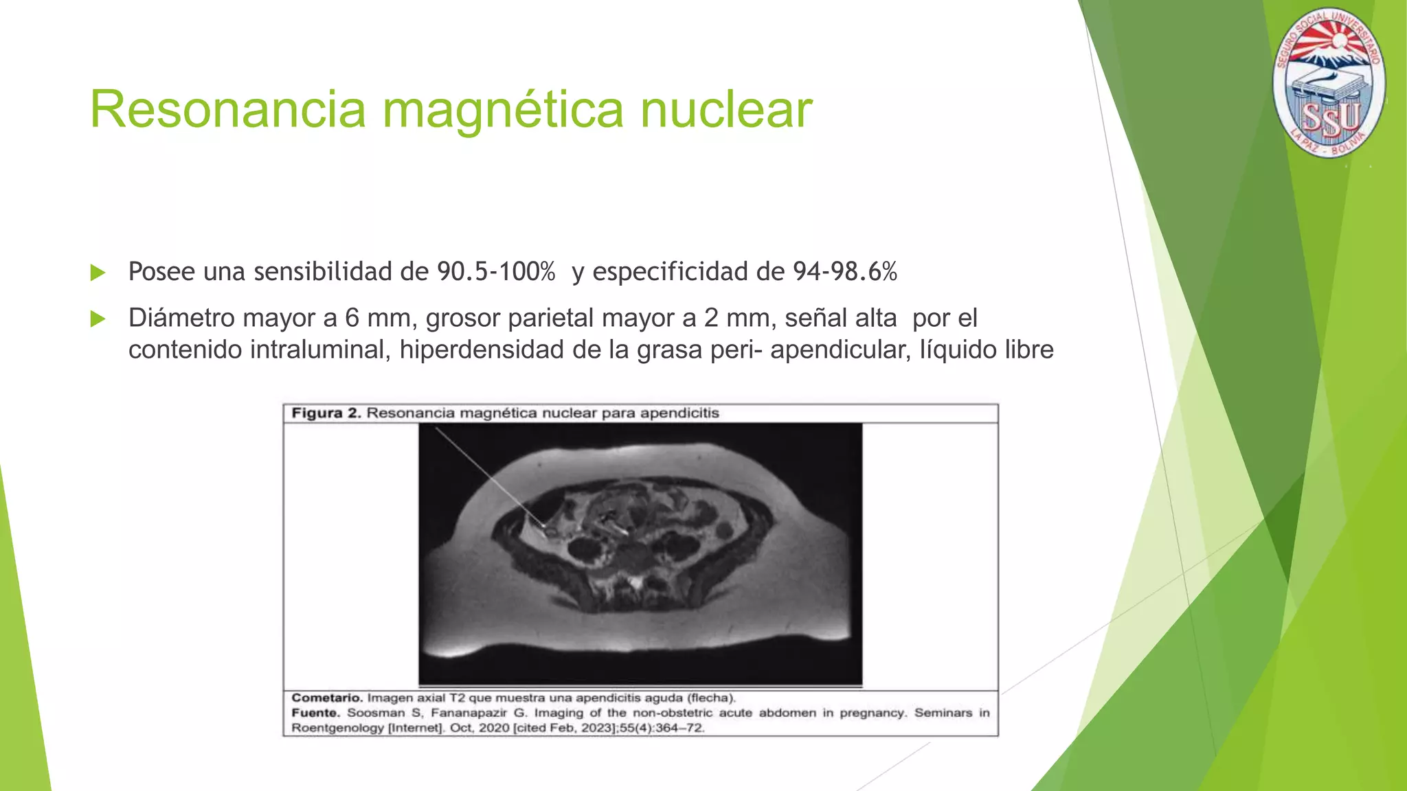 APENDICITIS EMBARAZO-1.pptx