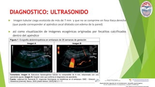 APENDICITIS EMBARAZO-1.pptx