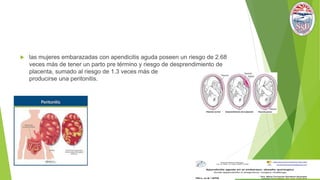APENDICITIS EMBARAZO-1.pptx