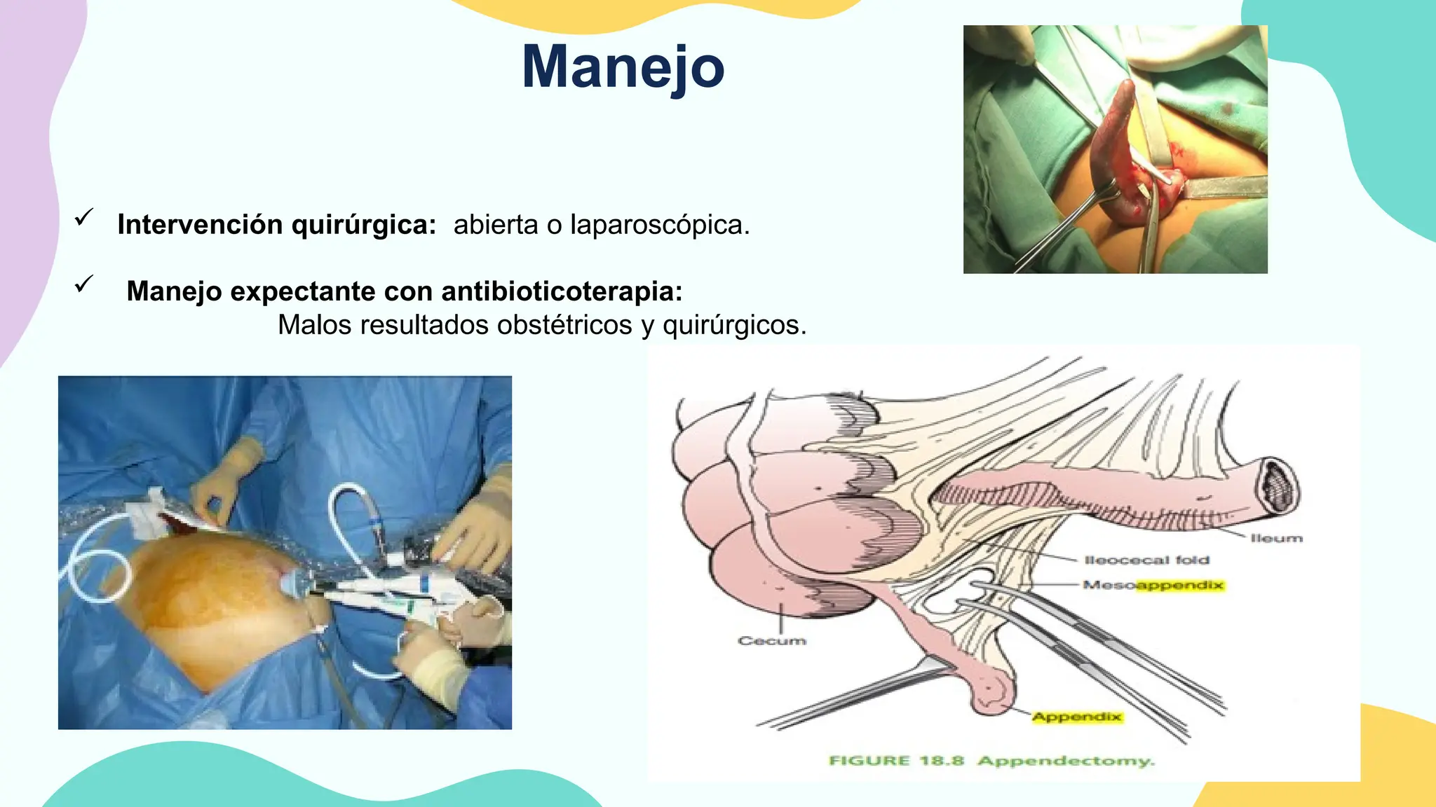 Apendicitis_en_el_embarazo.pptx medicina | PPTX