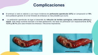 Apendicitis_en_el_embarazo.pptx medicina | PPTX